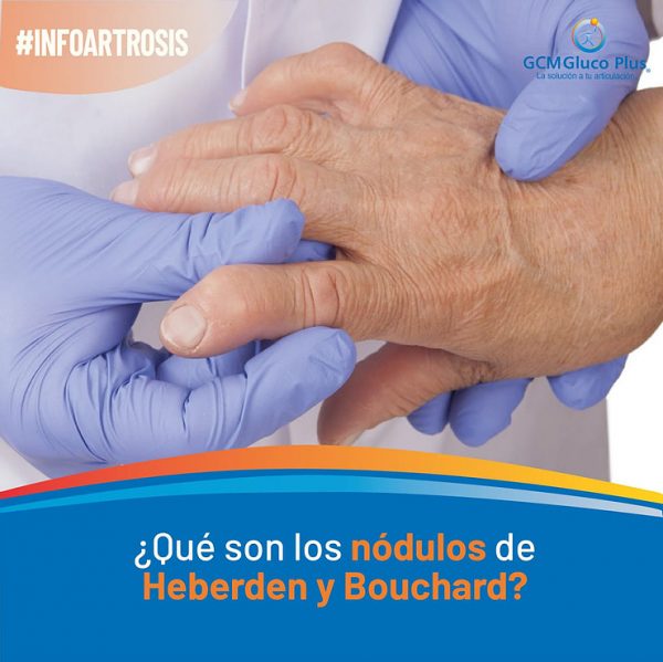 ¿Qué son los nódulos de Heberden y Bouchard? - GCM GlucoPlus